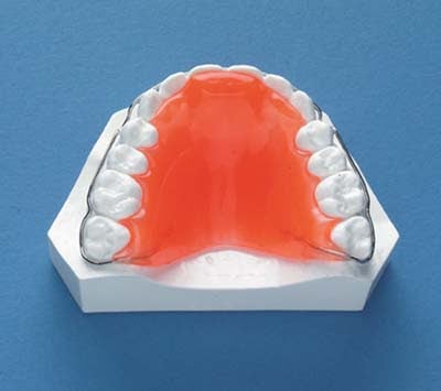 Appliances - Pittman Dental Laboratory